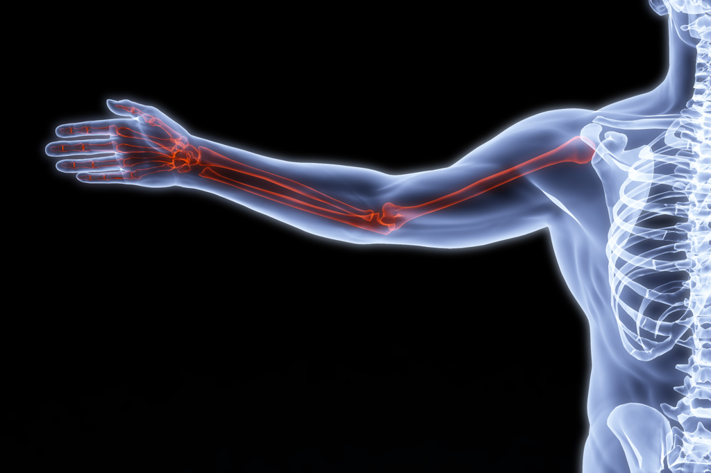 Posture and Injury Prevention by Vera Baadjou | Together in Music